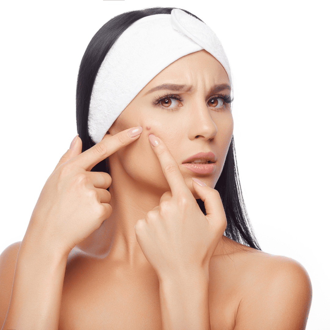 WHAT IS EXCORIATION DISORDER? | Kiki Skin & Body Spa